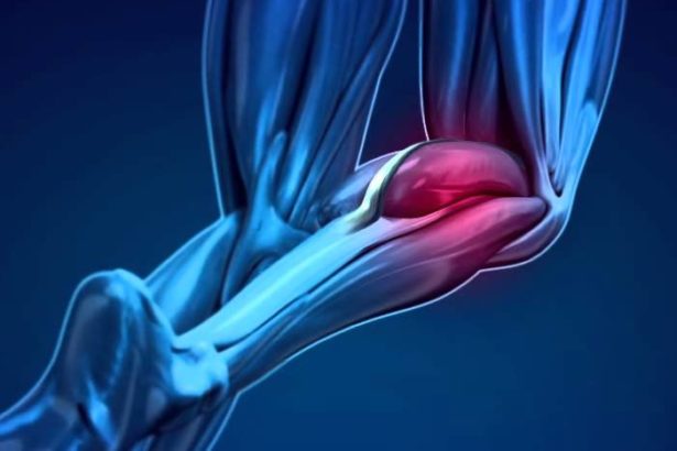 Ruptures & déchirures